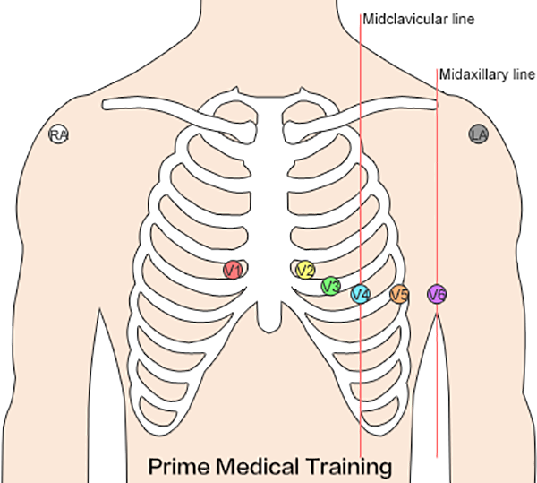 The Ultimate 12 Lead Ecg Placement Guide With Illustrations